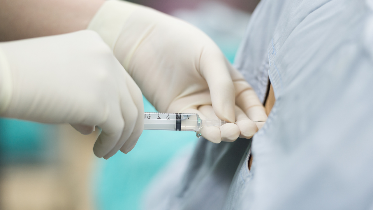 Top Benefits of Epidural Steroid Injections for Chronic Pain Relief